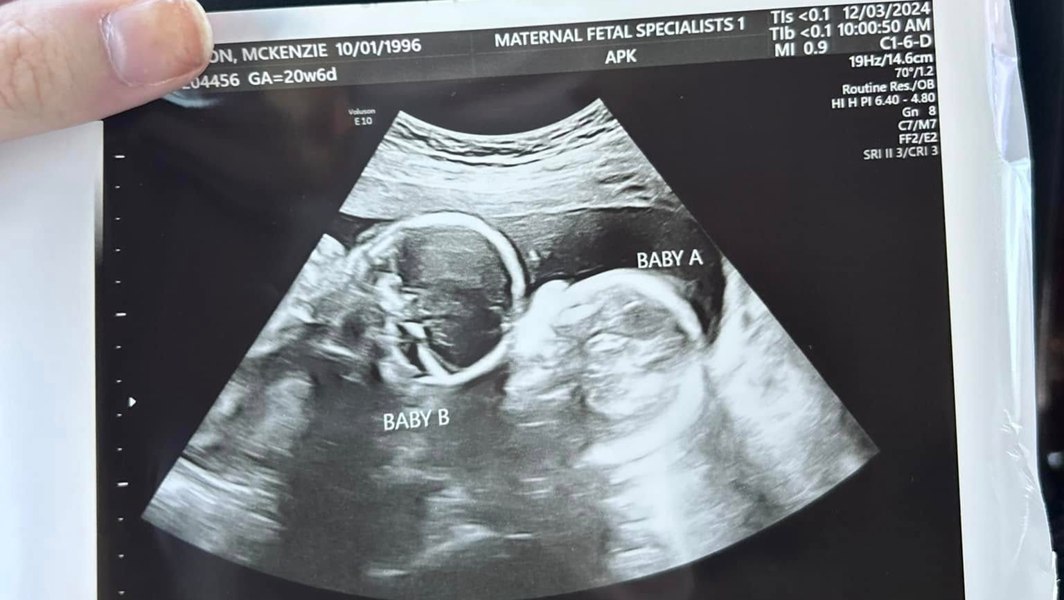 Fundraiser for Trey Hampton by Kia Boyd : Kenzie's Extended Hospital ...