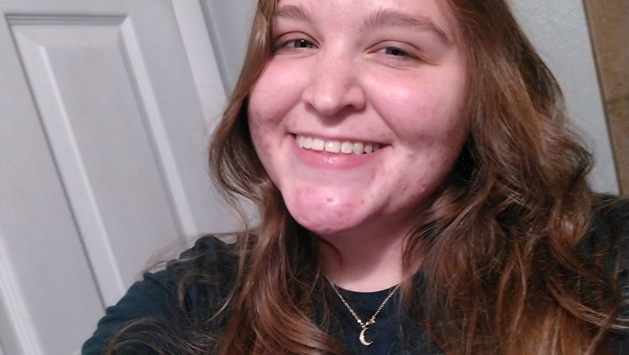 Fundraiser by Danielle Rust : Dental Crown Fundraiser for My Front Tooth