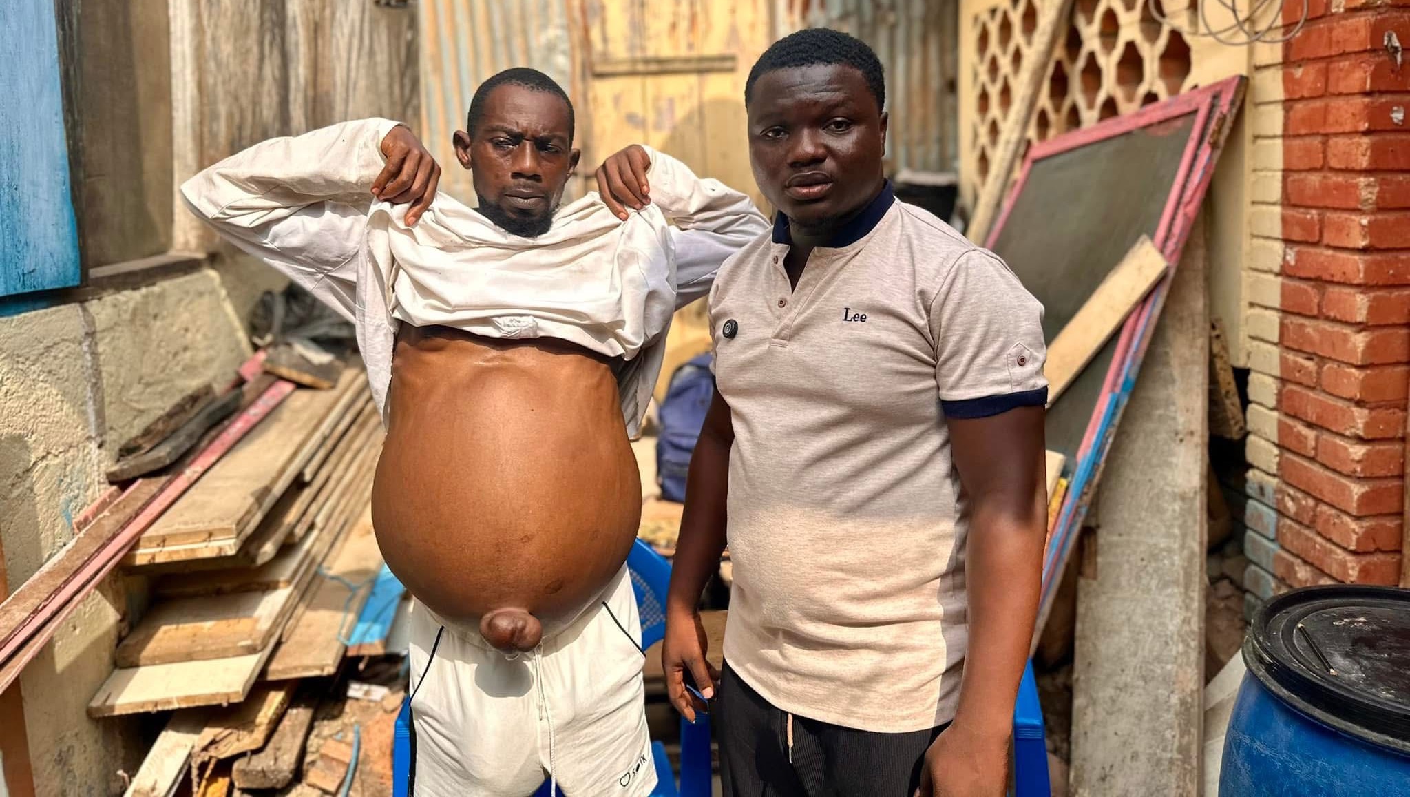 Fundraiser by BM FOUNDATION : A Support for Mr Kofi John to Undergo a ...