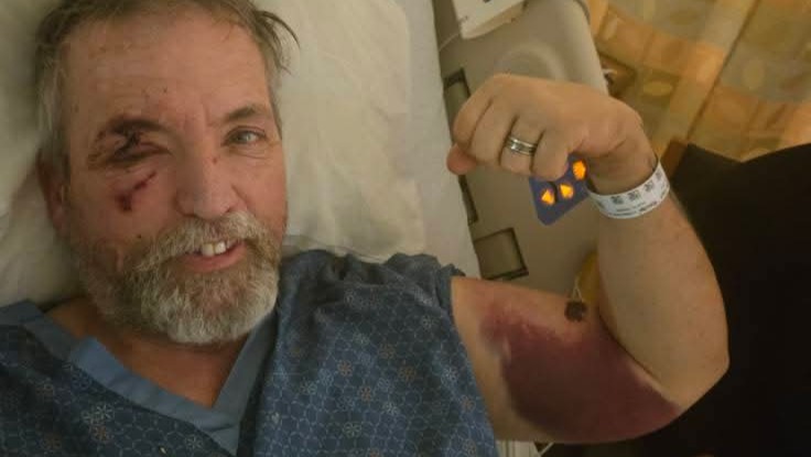 Fundraiser by Randy Herman : Support Randy during this process and ...