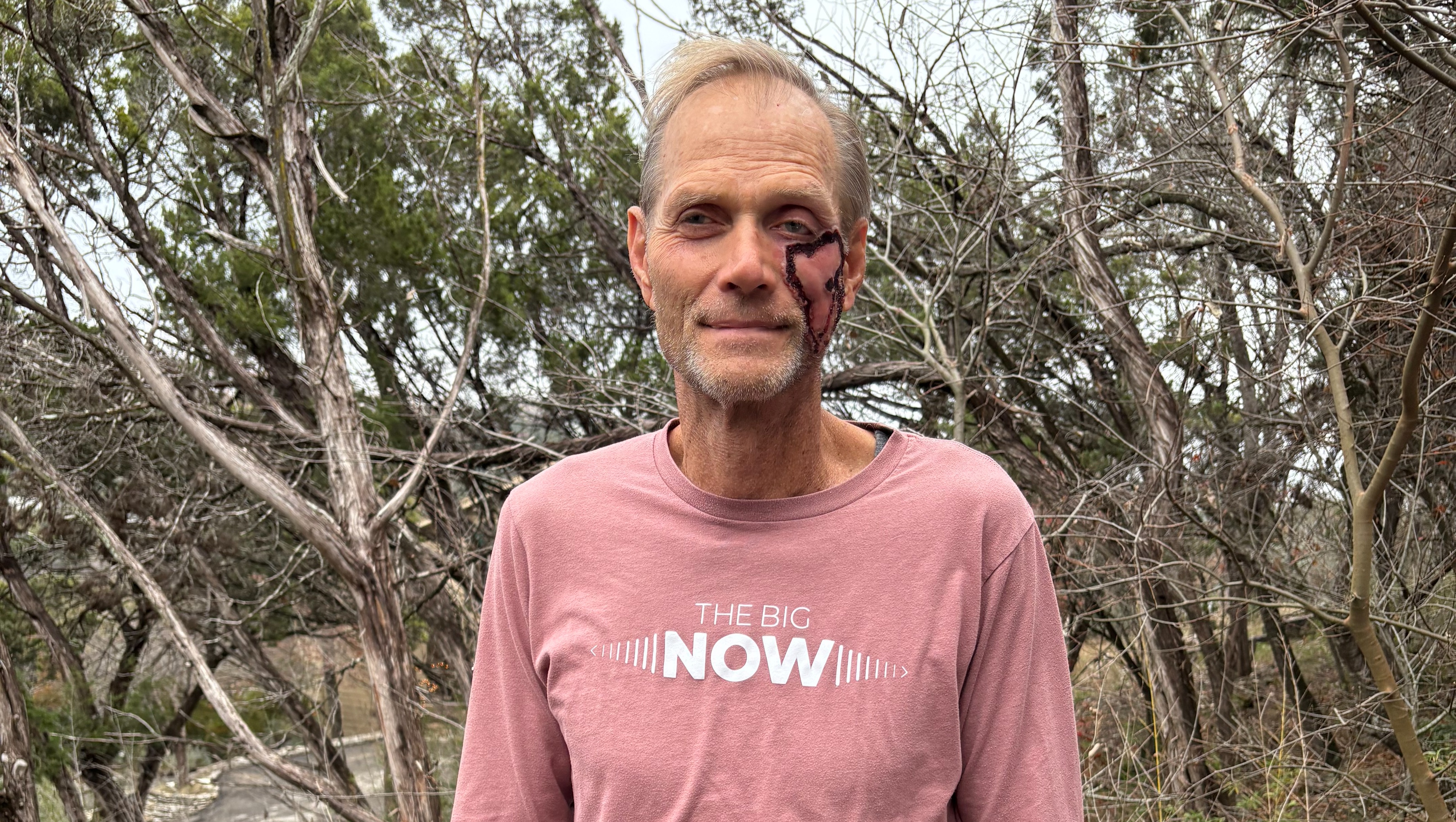 Fundraiser by Michelle Drerup : Support Marius (Jimmer) McGary's ...