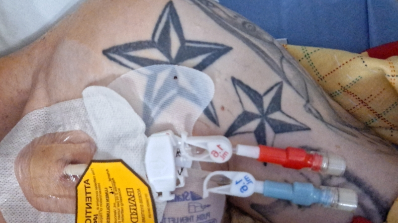 Fundraiser by Clint Campbell : Help Clint Battle Kidney Disease and ...