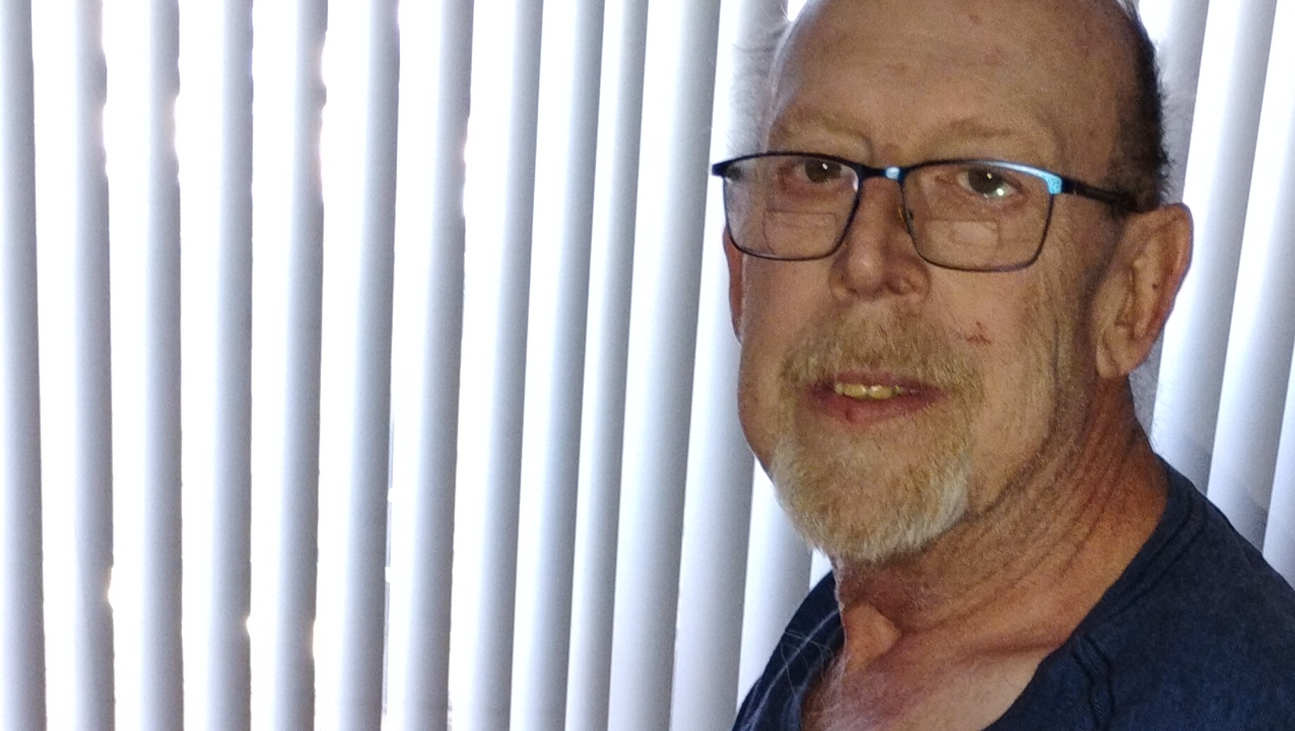 Fundraiser by Susan Rothwell Rothwell : Support Scott's Fight Against ...