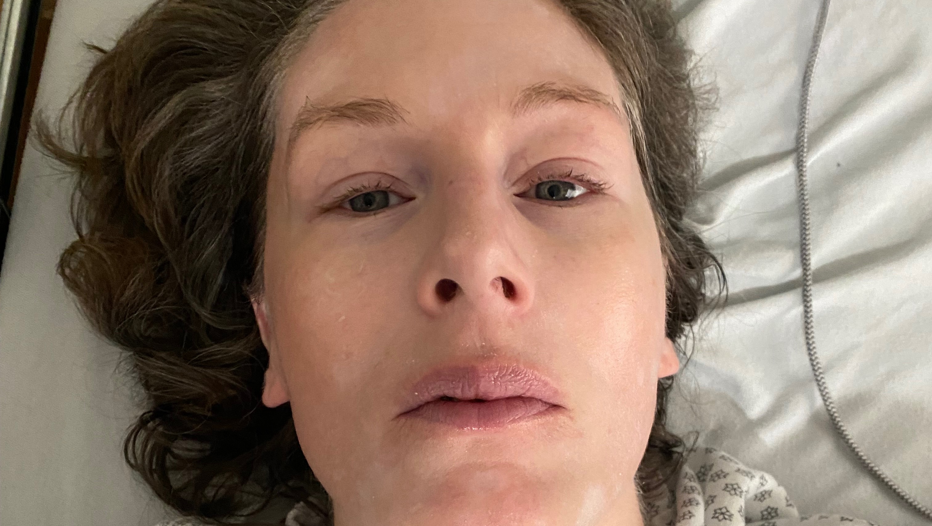 Fundraiser by Jessica Hunt : Bedbound Jessica Needs Life-Changing Surgery