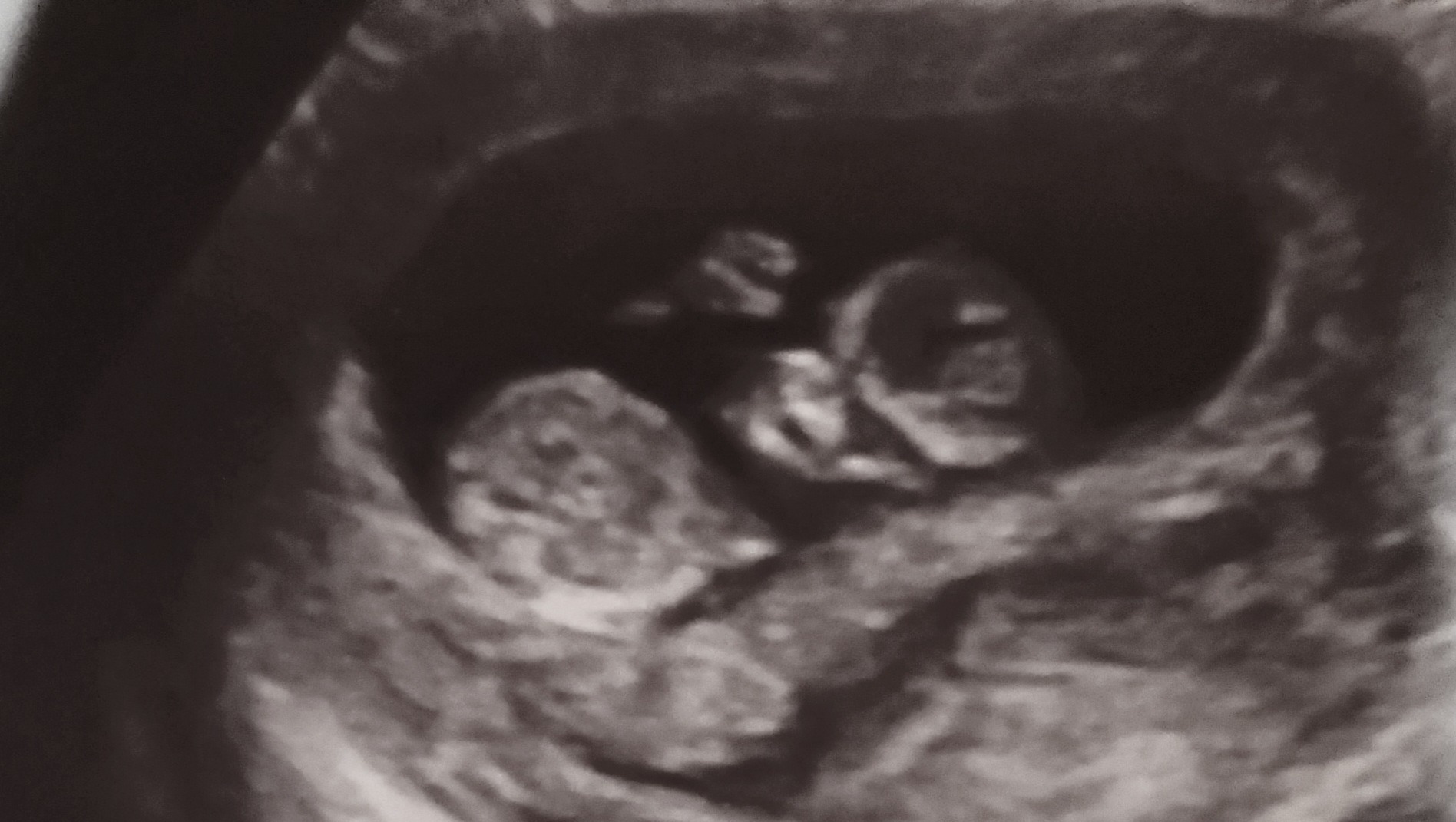 Fundraiser by Kristina Adcock : Support Kali's Journey to Dallas for ...