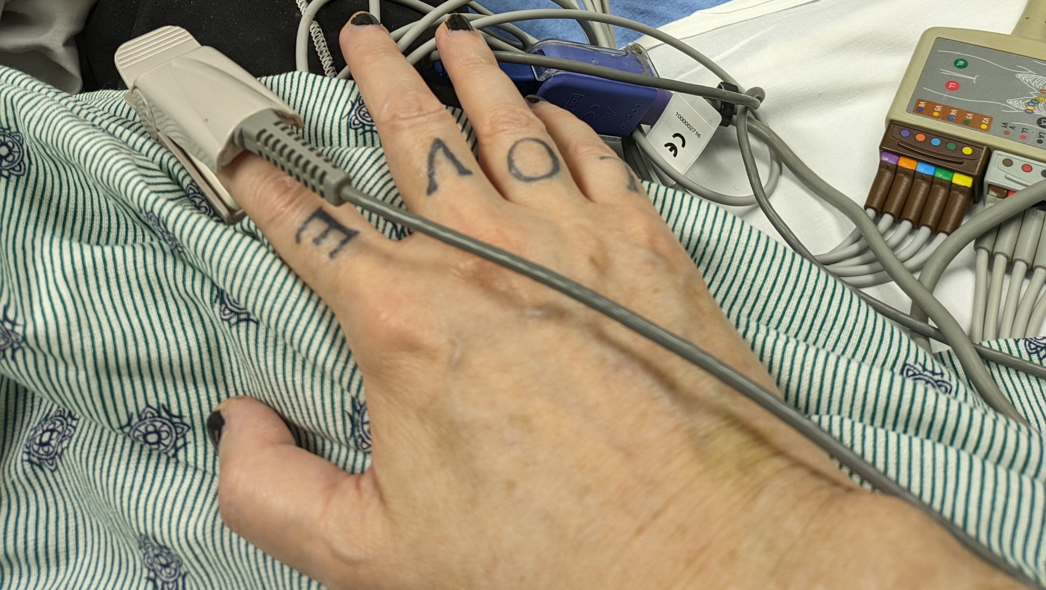 Fundraiser for Raven Creature by Shasta Slone : Help Raven Get a New ...