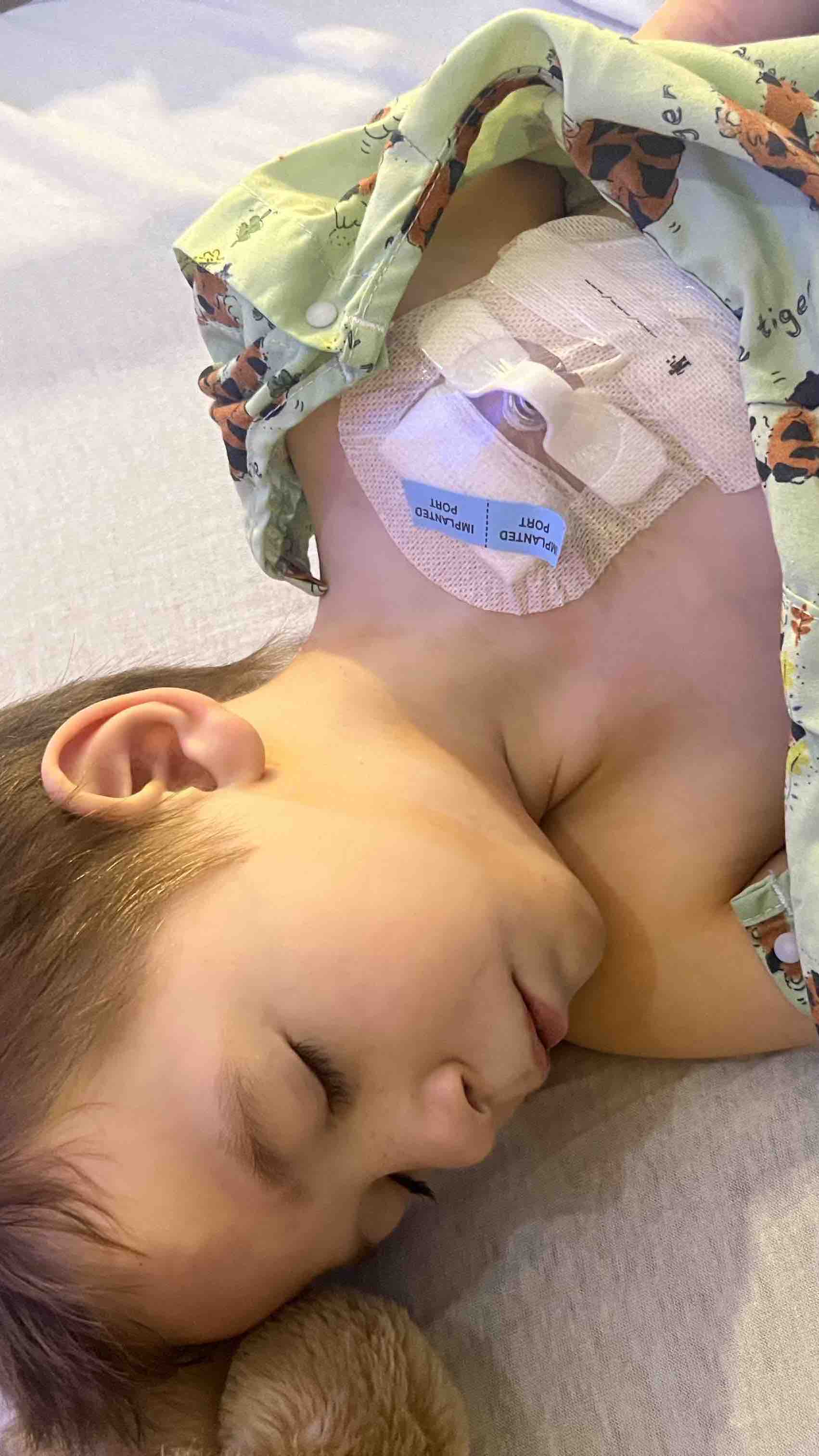 Fundraiser by Nicholas Slaga : Support Brysten's Journey to Recovery