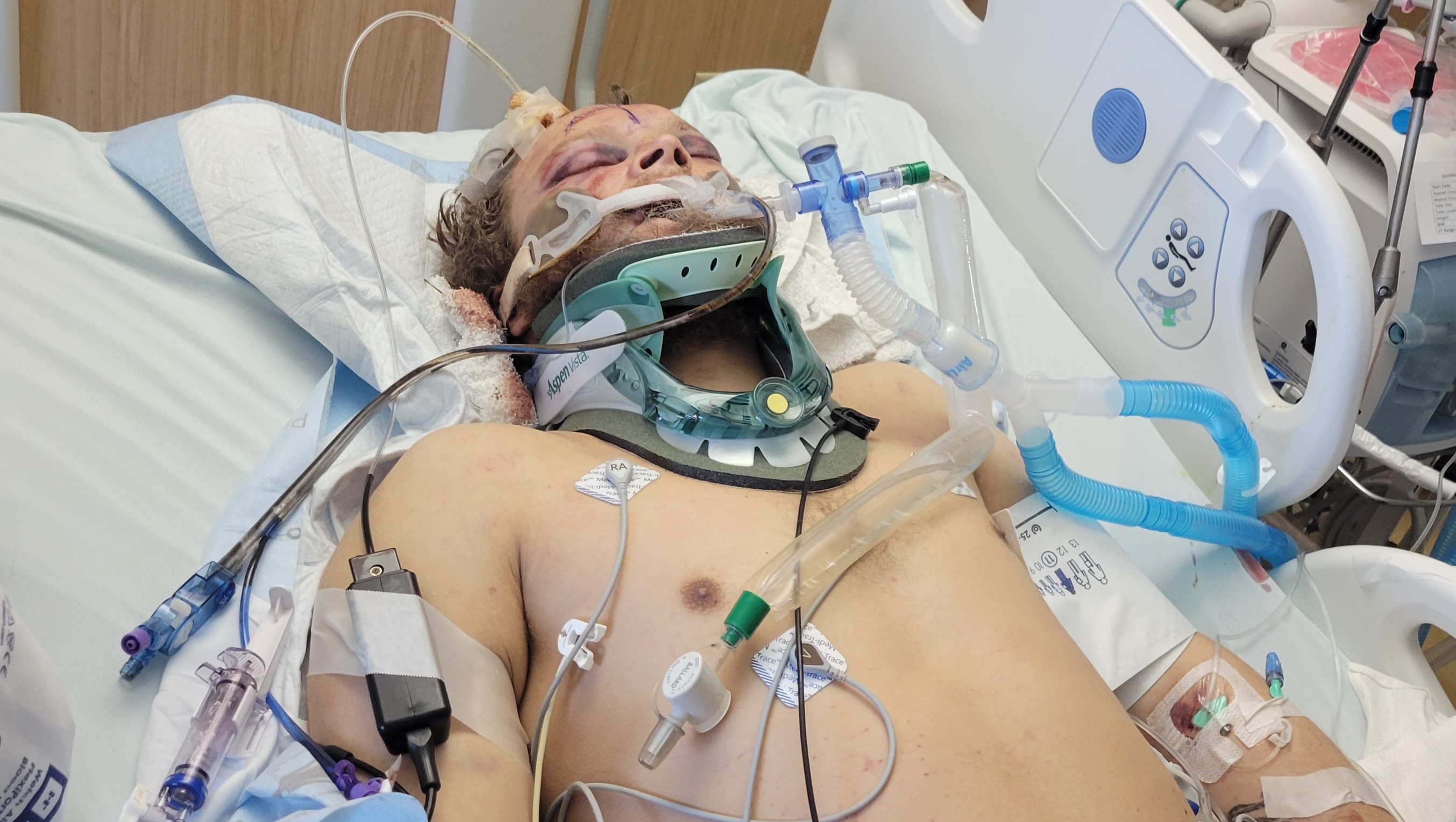 Fundraiser for Alissa Kollman by Kayla Lyberger : Aid James Kollman's ...