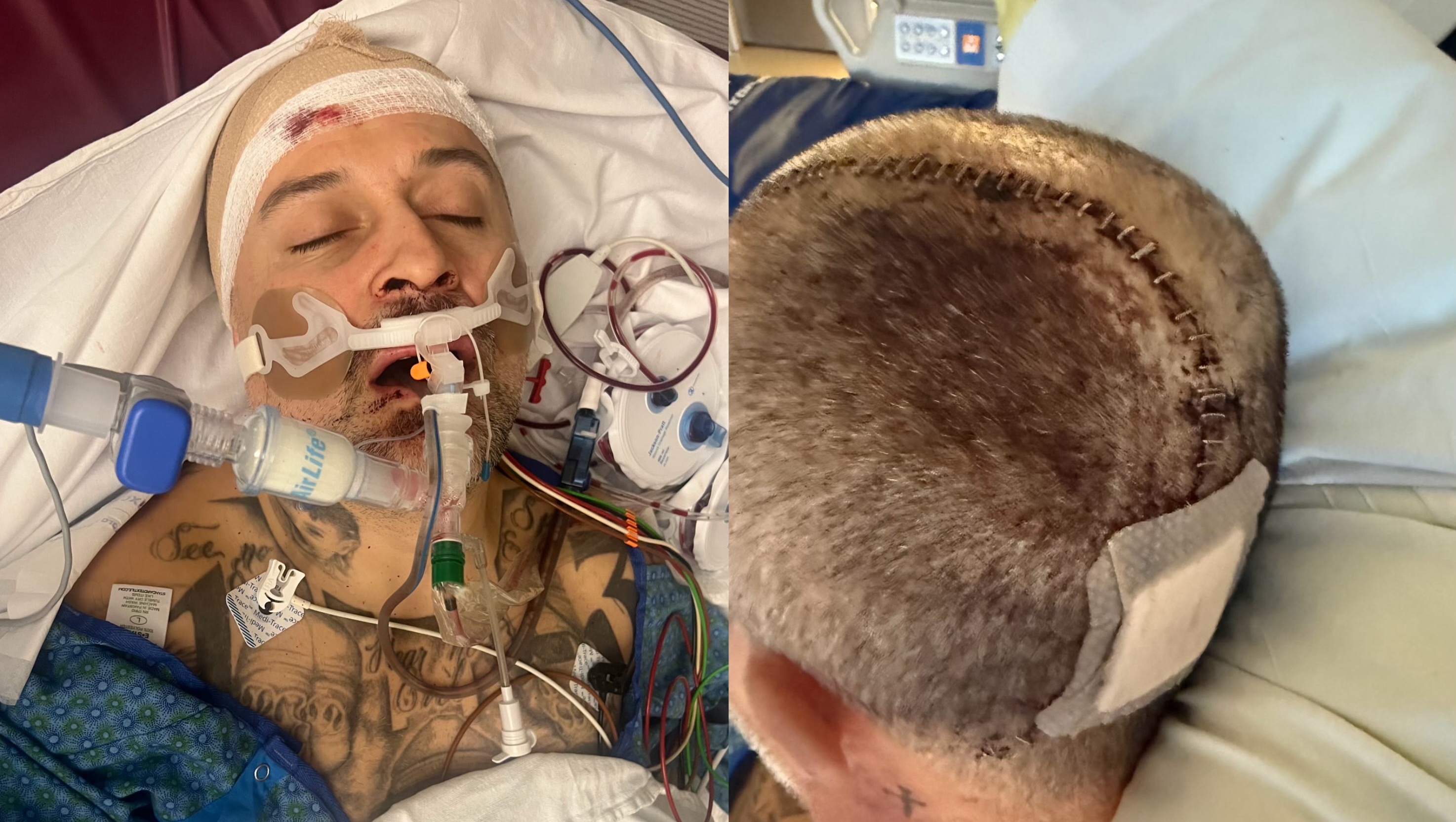 Fundraiser for Joe Saiz by Juan Garcia : Support Joe Lobo Saiz Journey ...