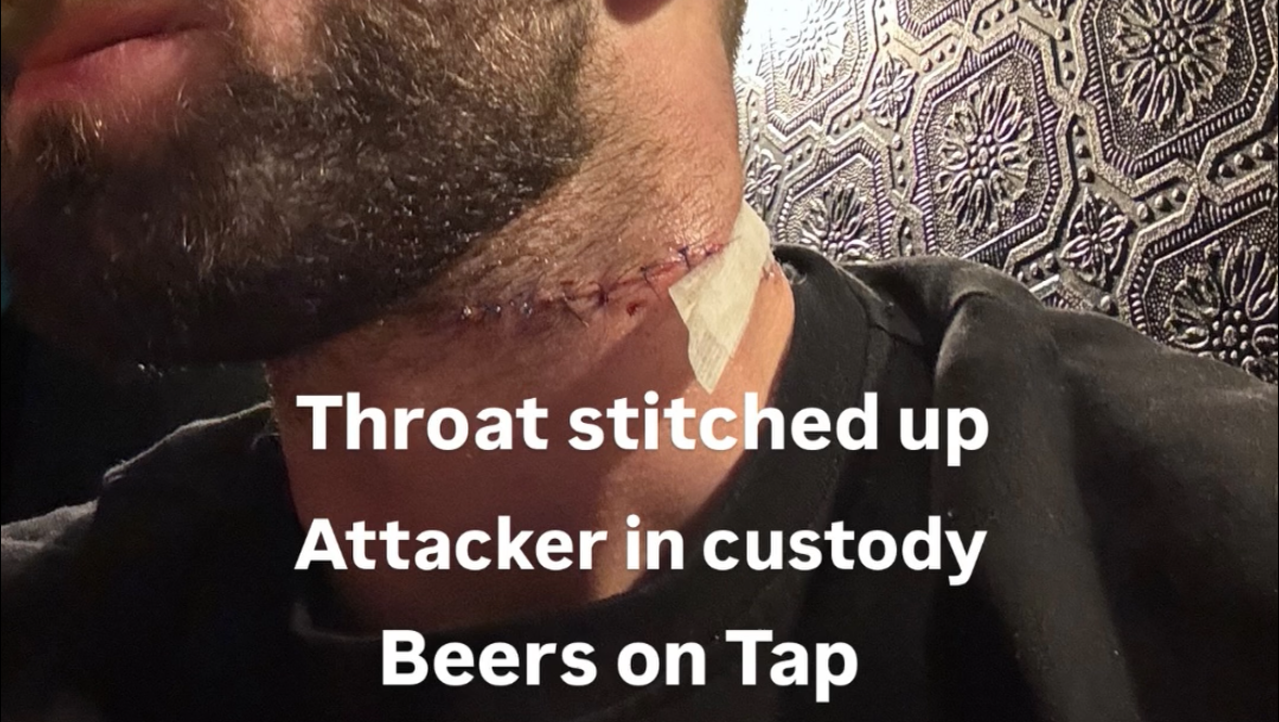 Fundraiser for Cormac O’Connell by James Gray : Dublin stabbing victim ...