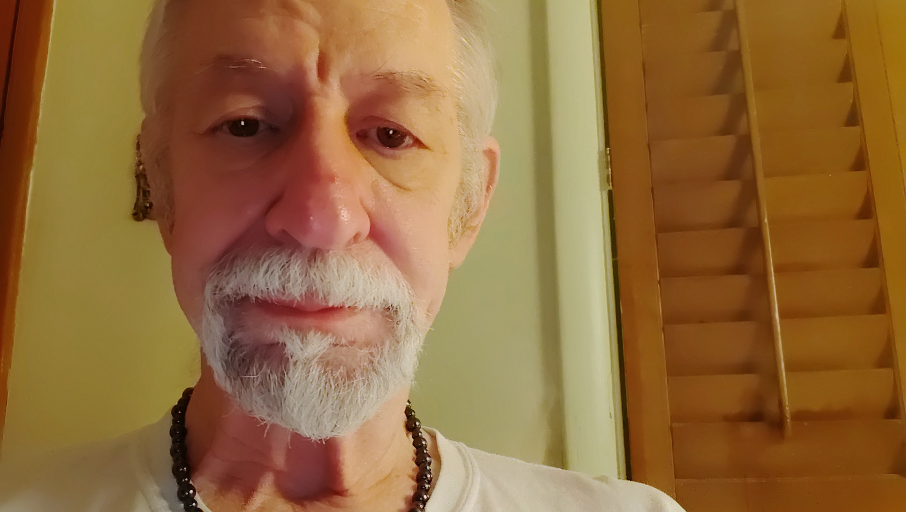 Fundraiser by Joe Roe : Joe's Healing Journey Needs Your Support