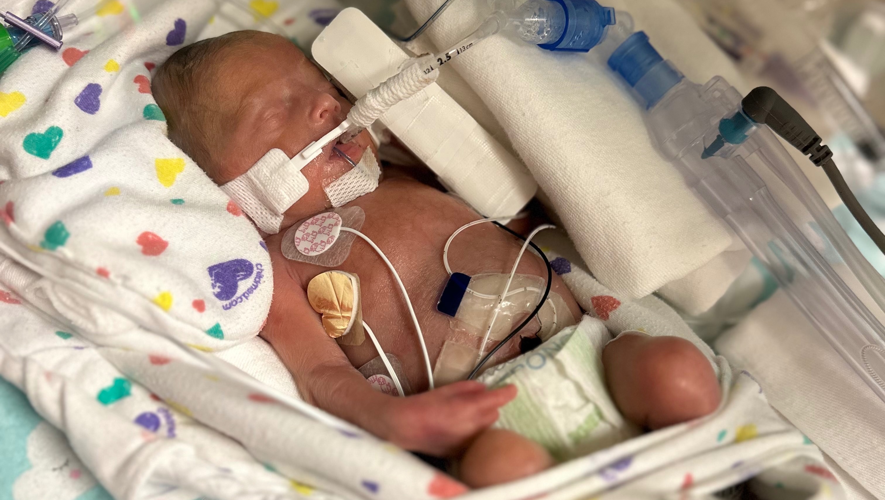 Fundraiser for Lacey Gray by Holly Coleman : Fuel Braxton's Recovery at ...