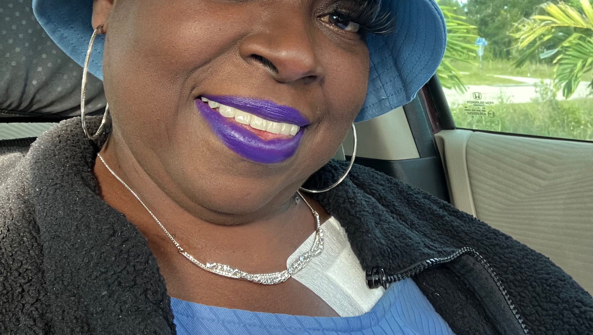Fundraiser by Sharon Frederick : Help Sharon's Recovery After Kidney ...