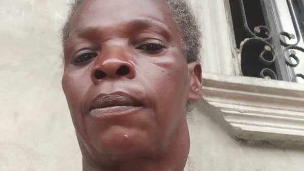 Fundraiser by María Milagrosa Nse obiang akumu : AYÚDAME A OPERAR A MI ...