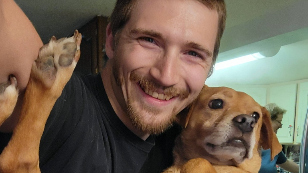 Fundraiser by Dylan Broderick : Need help to get back on my good leg ...