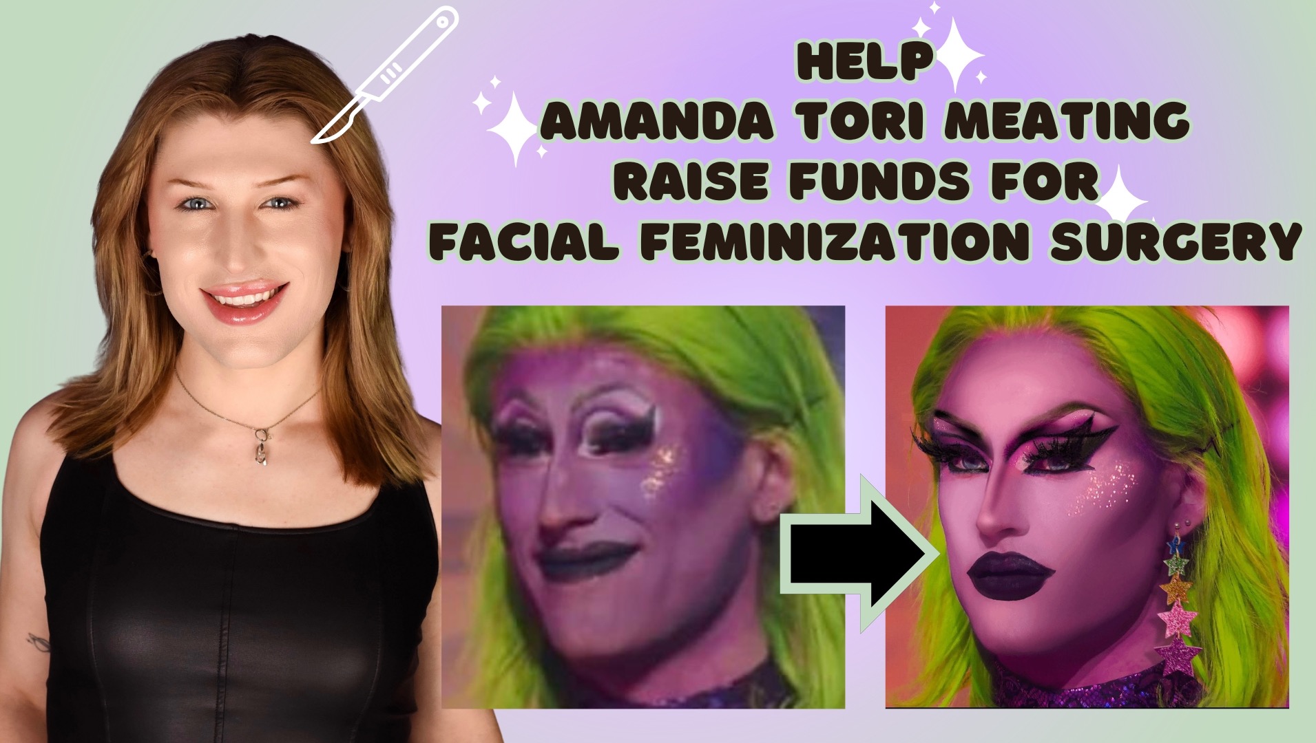 Fundraiser by Amanda Philipps : Support Amanda Tori Meating’s Facial ...