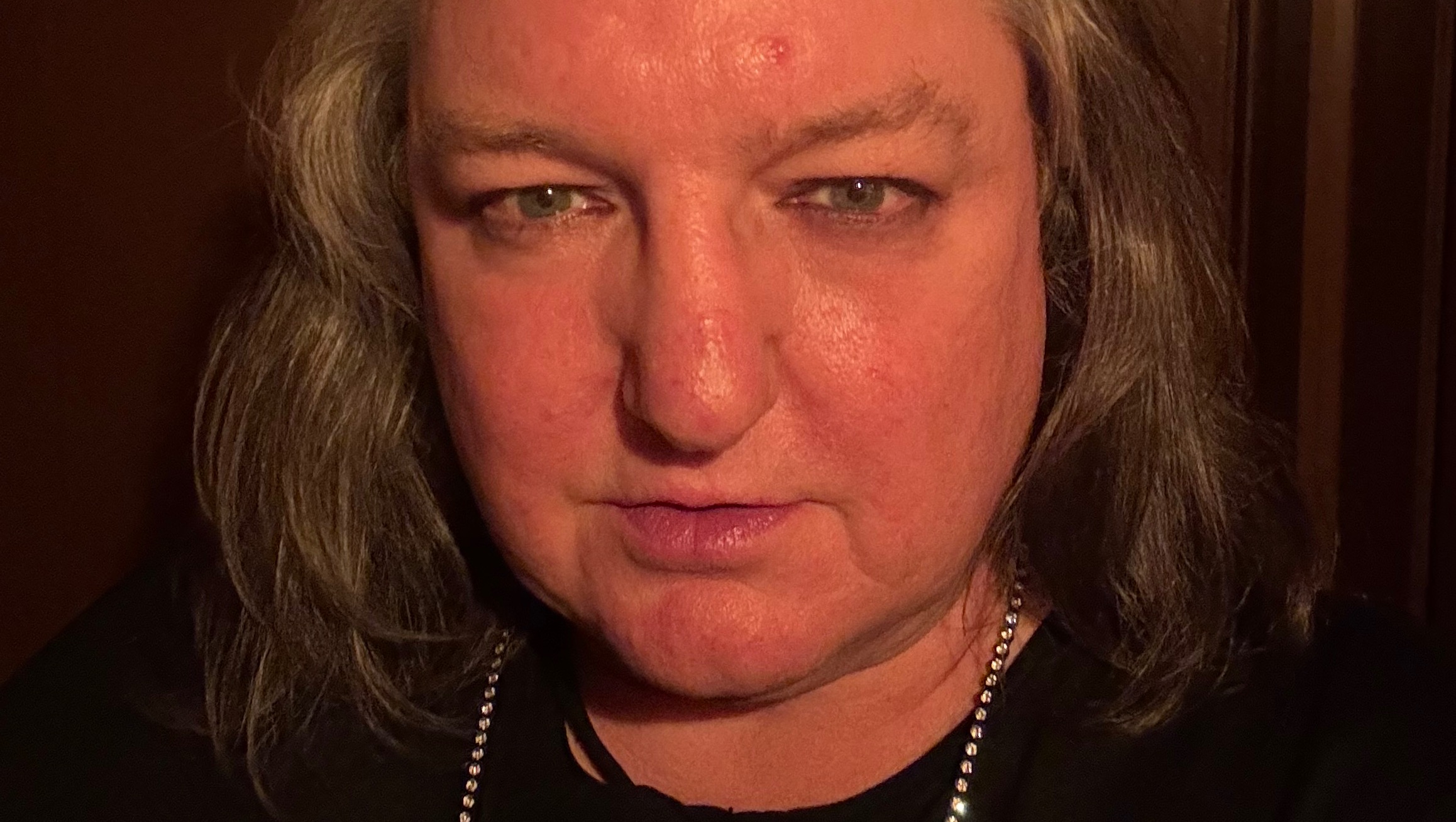 Fundraiser by Kevin Bohl : Help me get back on my feet