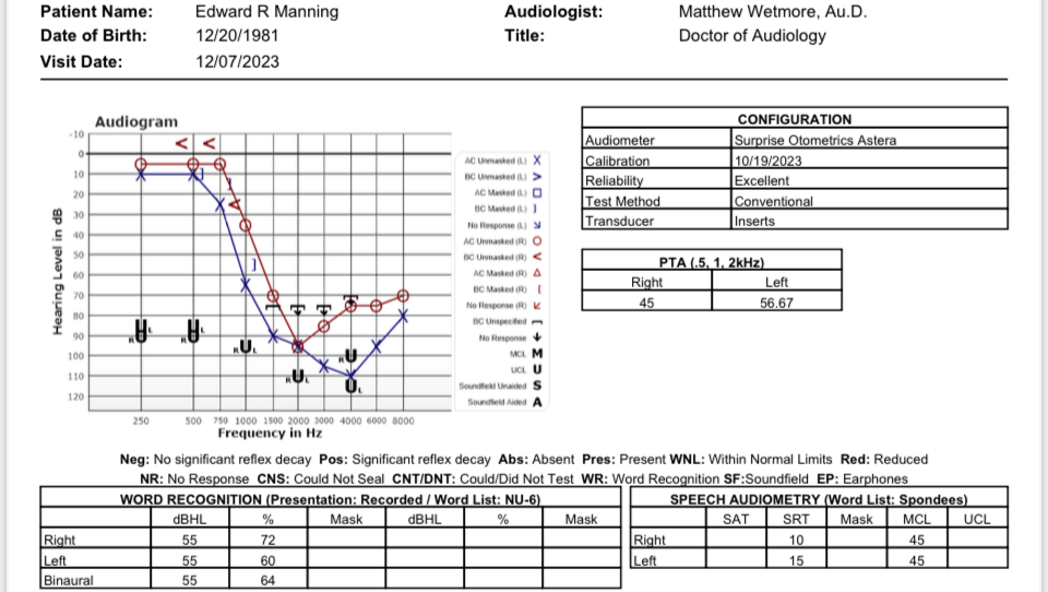 Fundraiser by Edward Manning : Support Edward's Hearing Aid Upgrade