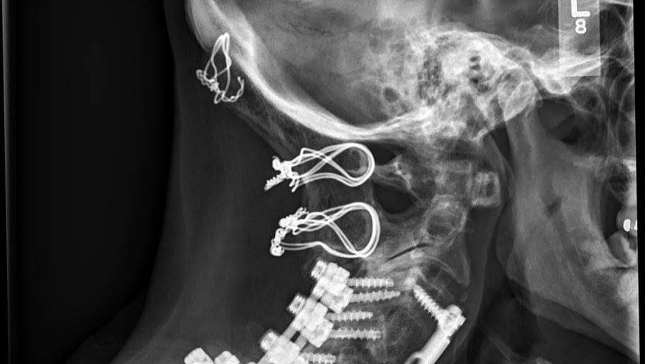 Fundraiser by bradley renn : Brian Renn Needs Your Help to Rebuild