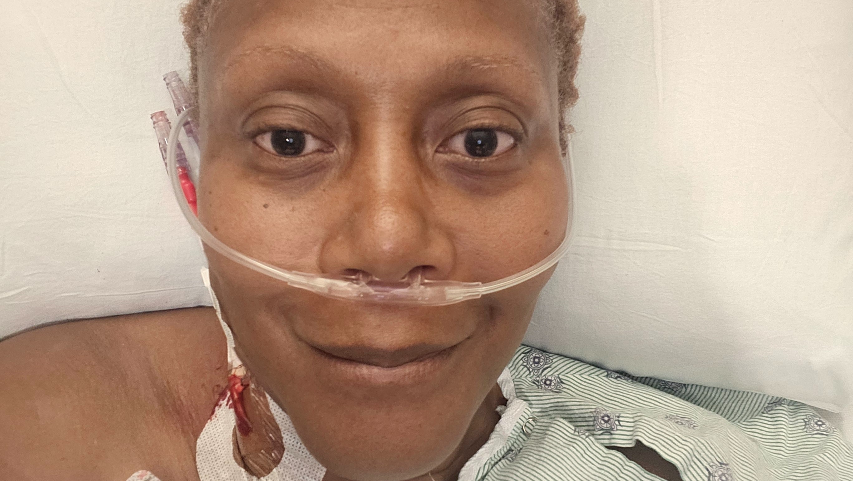 Fundraiser by Michelle Hill : Help Michelle Breathe Freely Again
