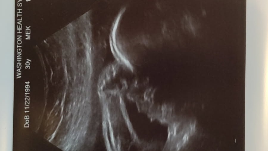 Fundraiser for Alexis Sears by Debbie Natale : Support Alexis and Jason ...