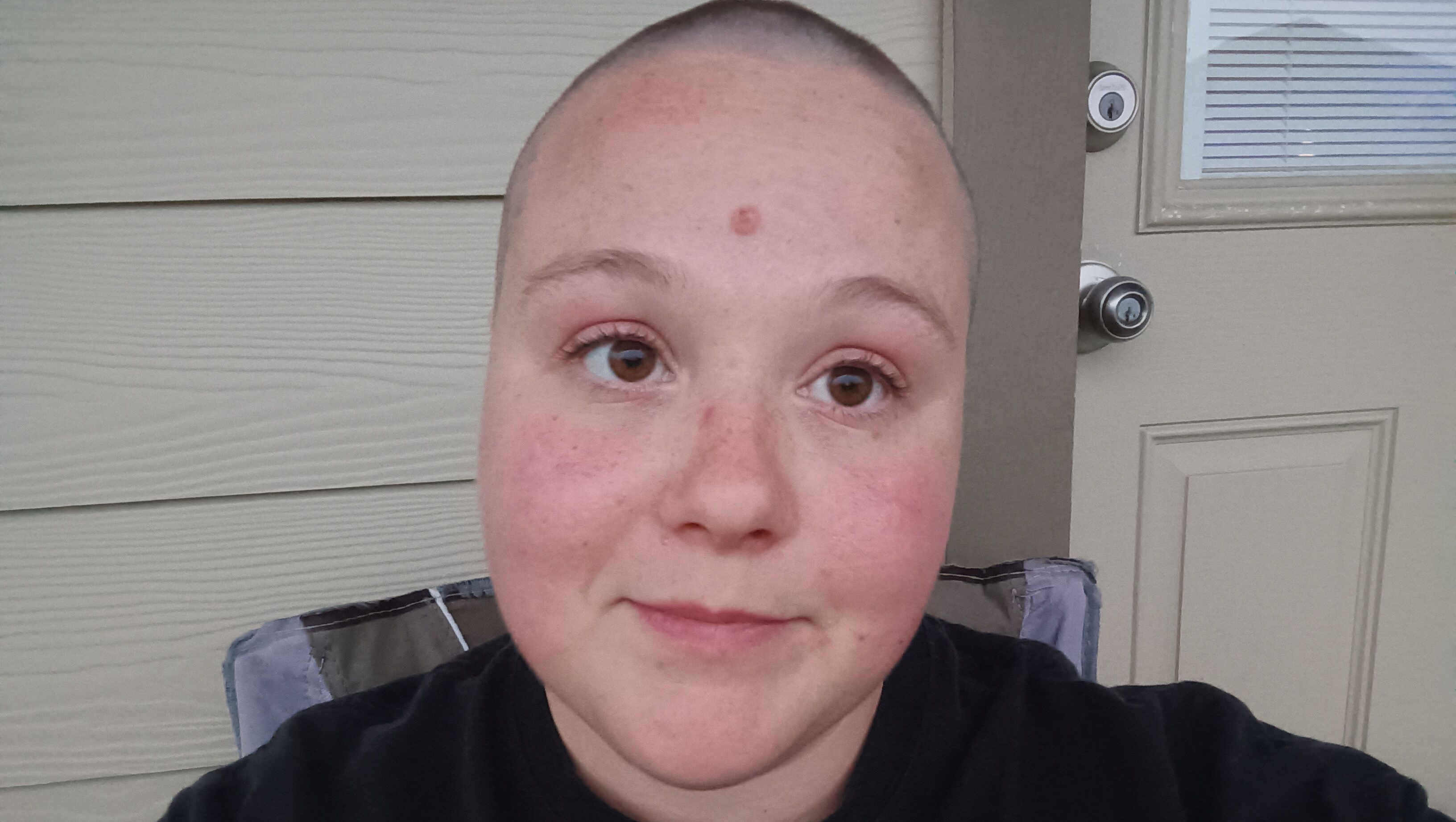 Fundraiser by Alexandria Owens-Campbell : Help Alexandria Battle Rare ...