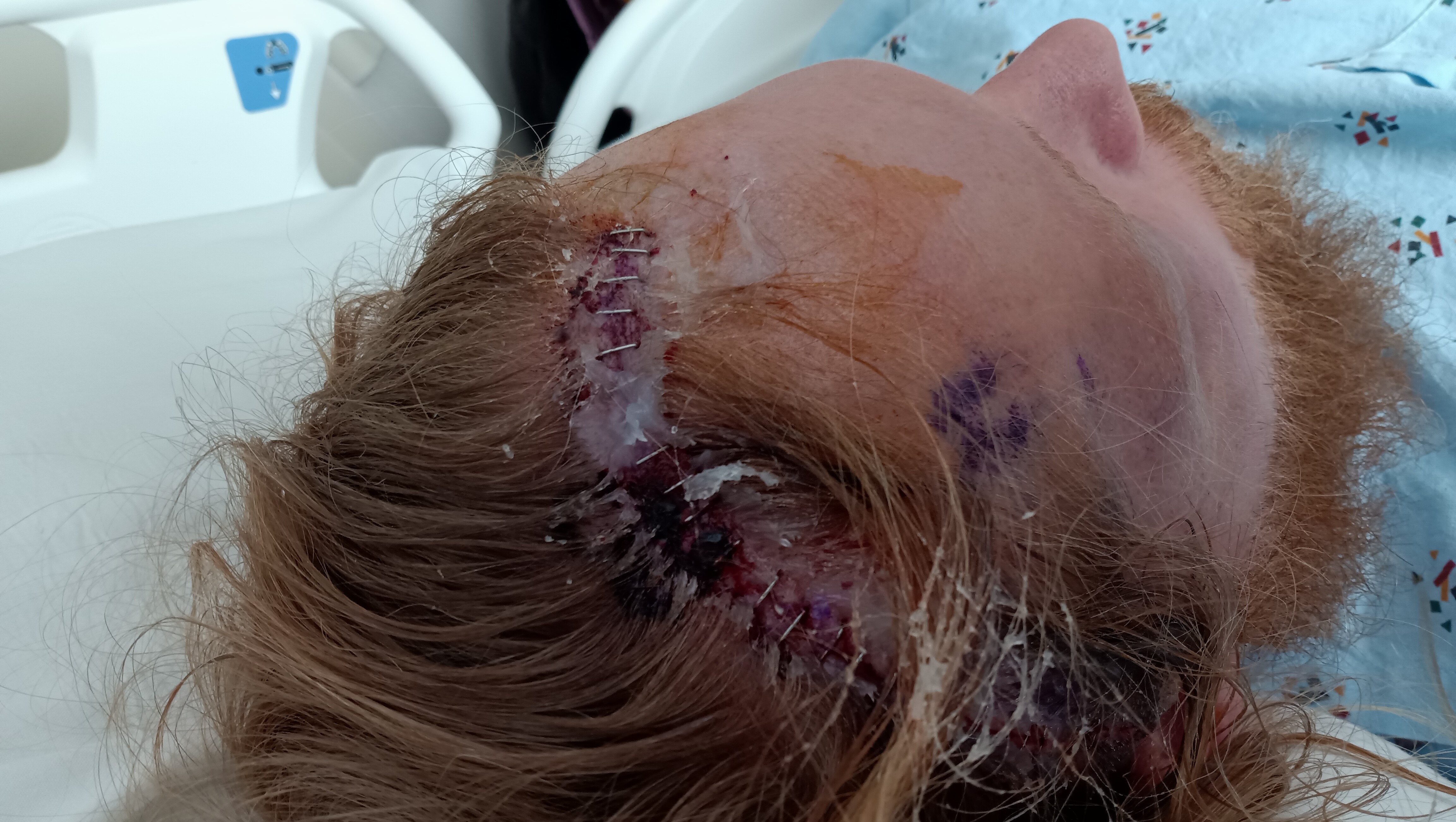 Fundraiser by Envy Knight : Help Joshua Knight recover from brain surgery