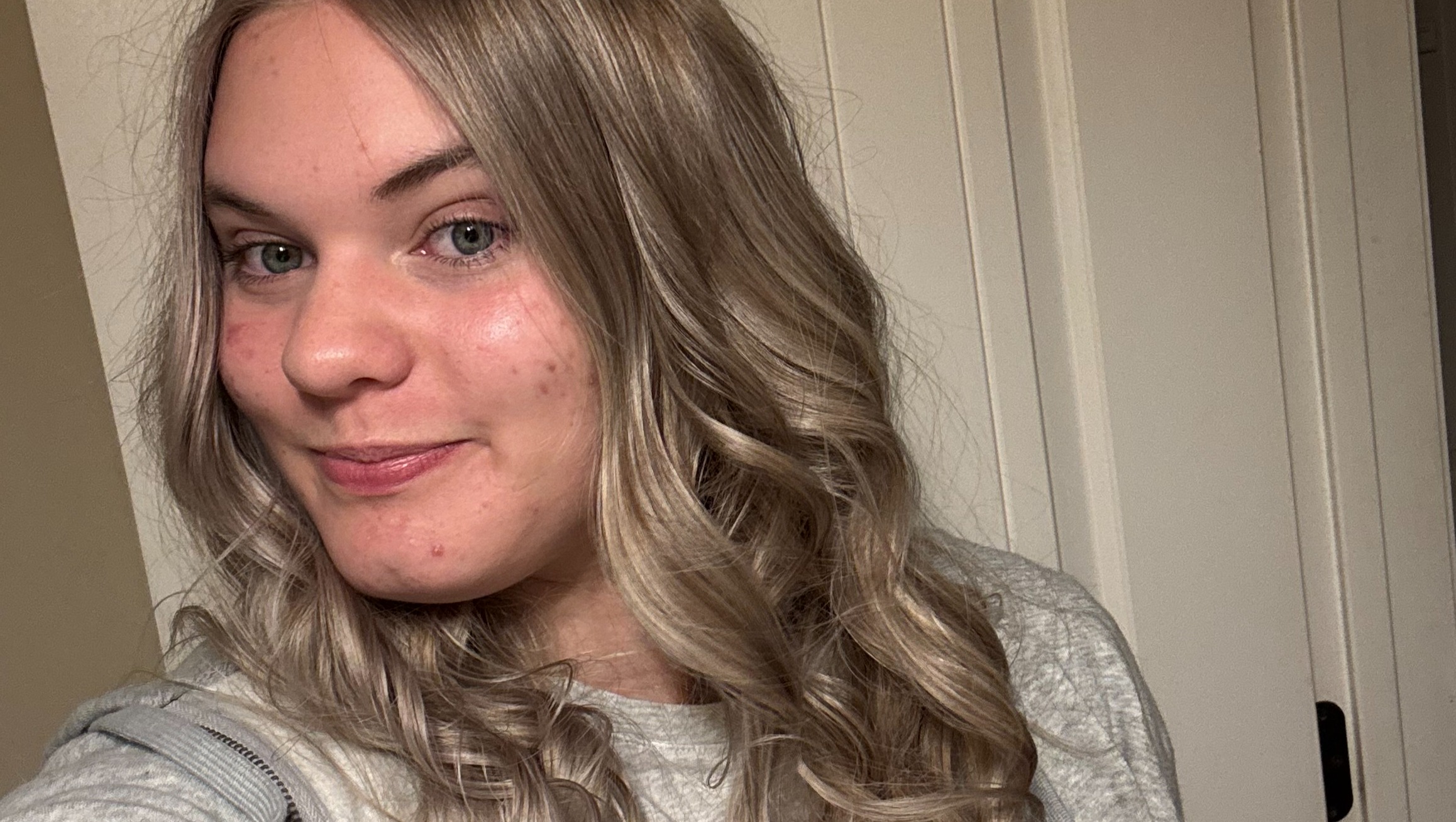 Fundraiser by Amanda Simpson : Support Grace's Battle with Ehler's-Danlos Syndrome