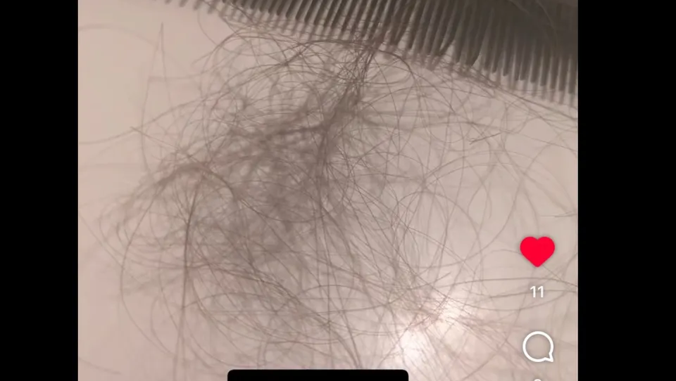 Fundraiser for Misty Scott-Carder by Susan Floyd : Time for a wig ...