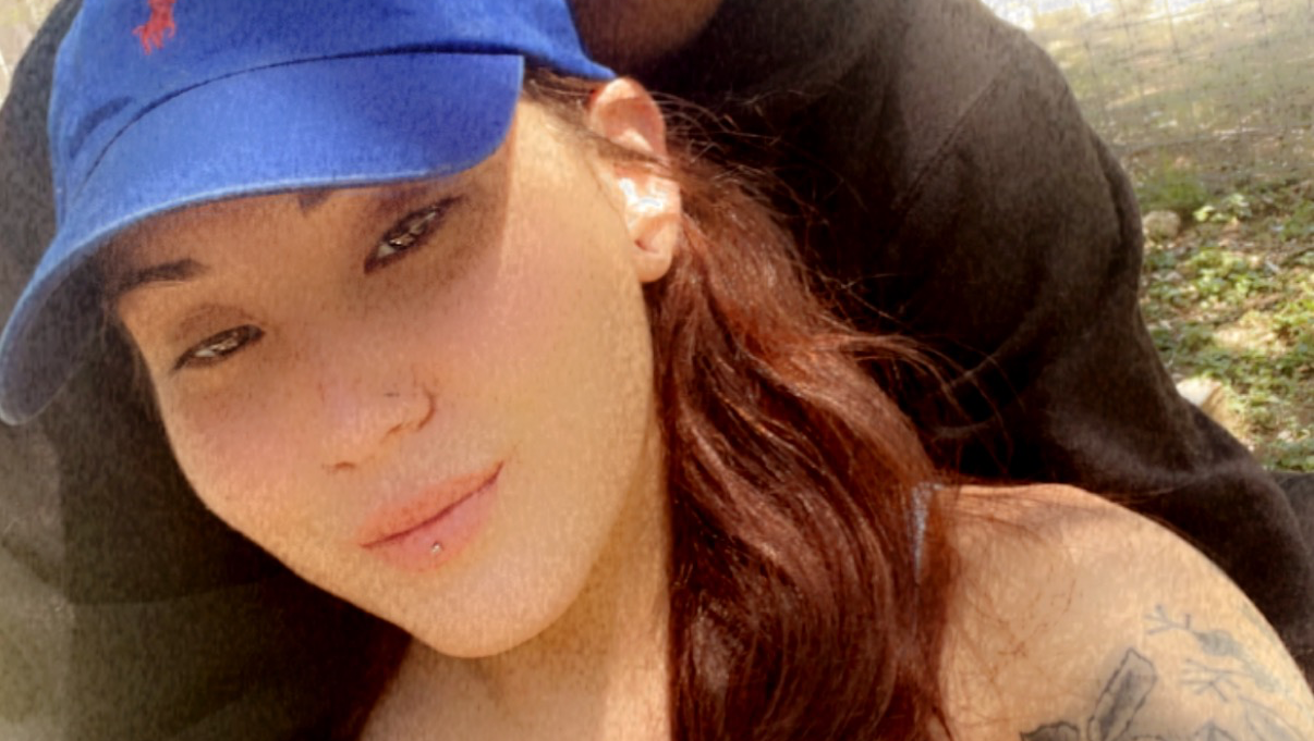 Fundraiser by Rebecca Inocencio : Help Bex Recover from Dog Attack Injuries