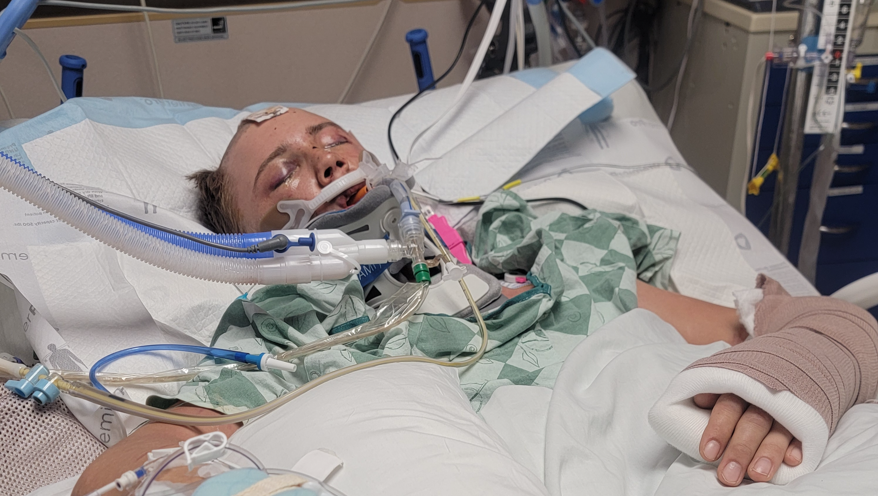 Fundraiser by Brandon Houdek : Help Evan Houdek Heal After Accident