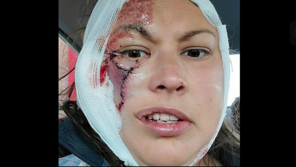 Fundraiser by Stephanie Jackson : Support Deborah's Reconstructive Surgery