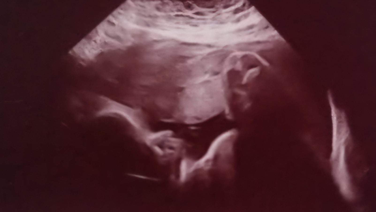 Fundraiser by Rachel Denney : Support Sandra's Journey to a Safe Delivery