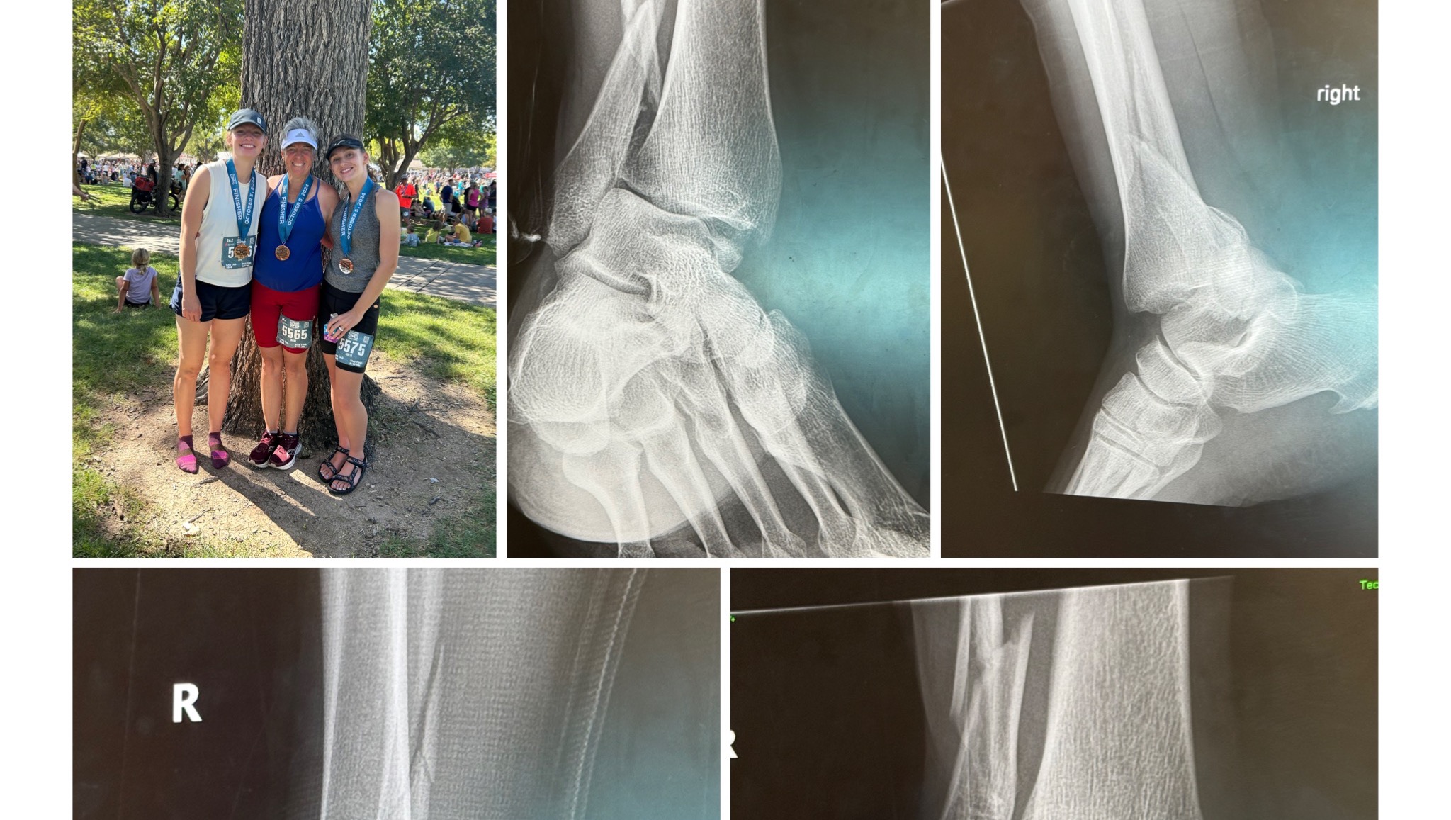 Fundraiser by Brooke Call : Irene Call Surgery