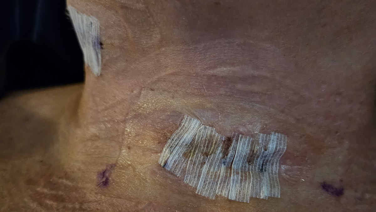 Fundraiser for Kat Lizaola by Lauren Rodriguez : Help Katherine and ...