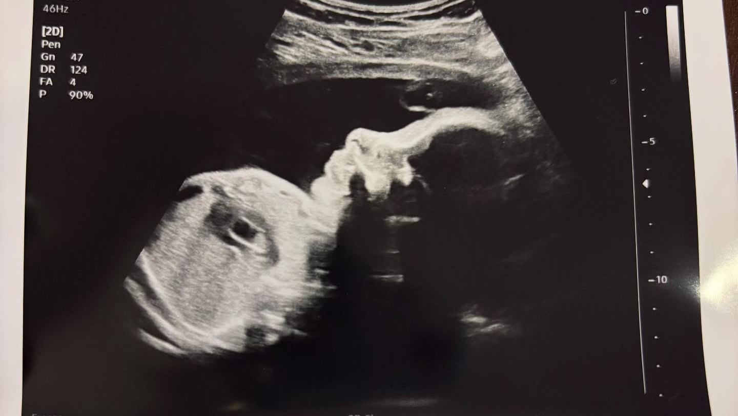 Fundraiser for Stephen Stratton by Kristen Campbell : Help Ashley ...