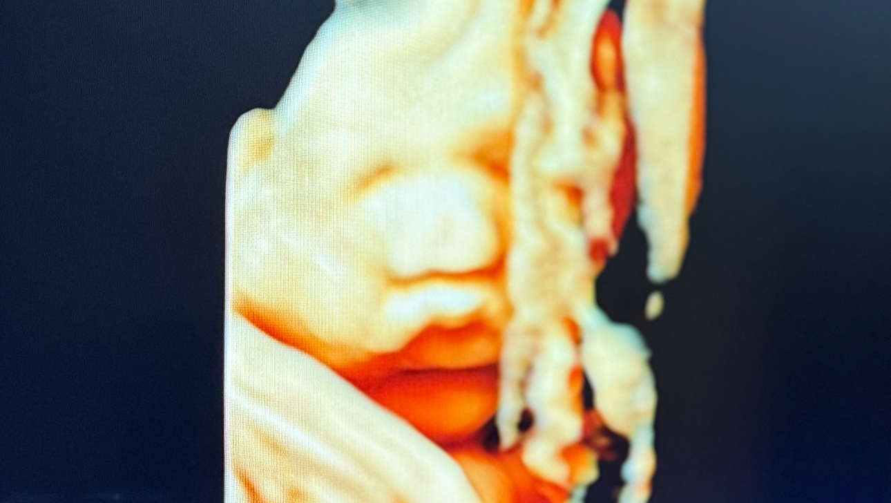 Fundraiser by Morgan Hutson : Join Us in Supporting Baby L's Journey