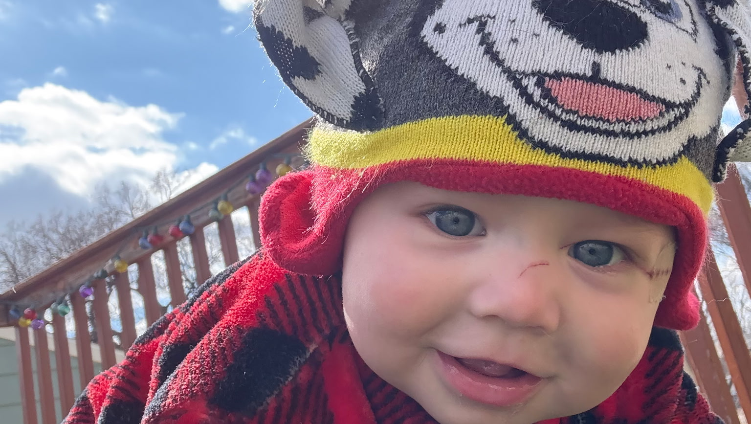 Fundraiser for Adrian Mead by Robert Meredith : Help Baby Rowan on his ...