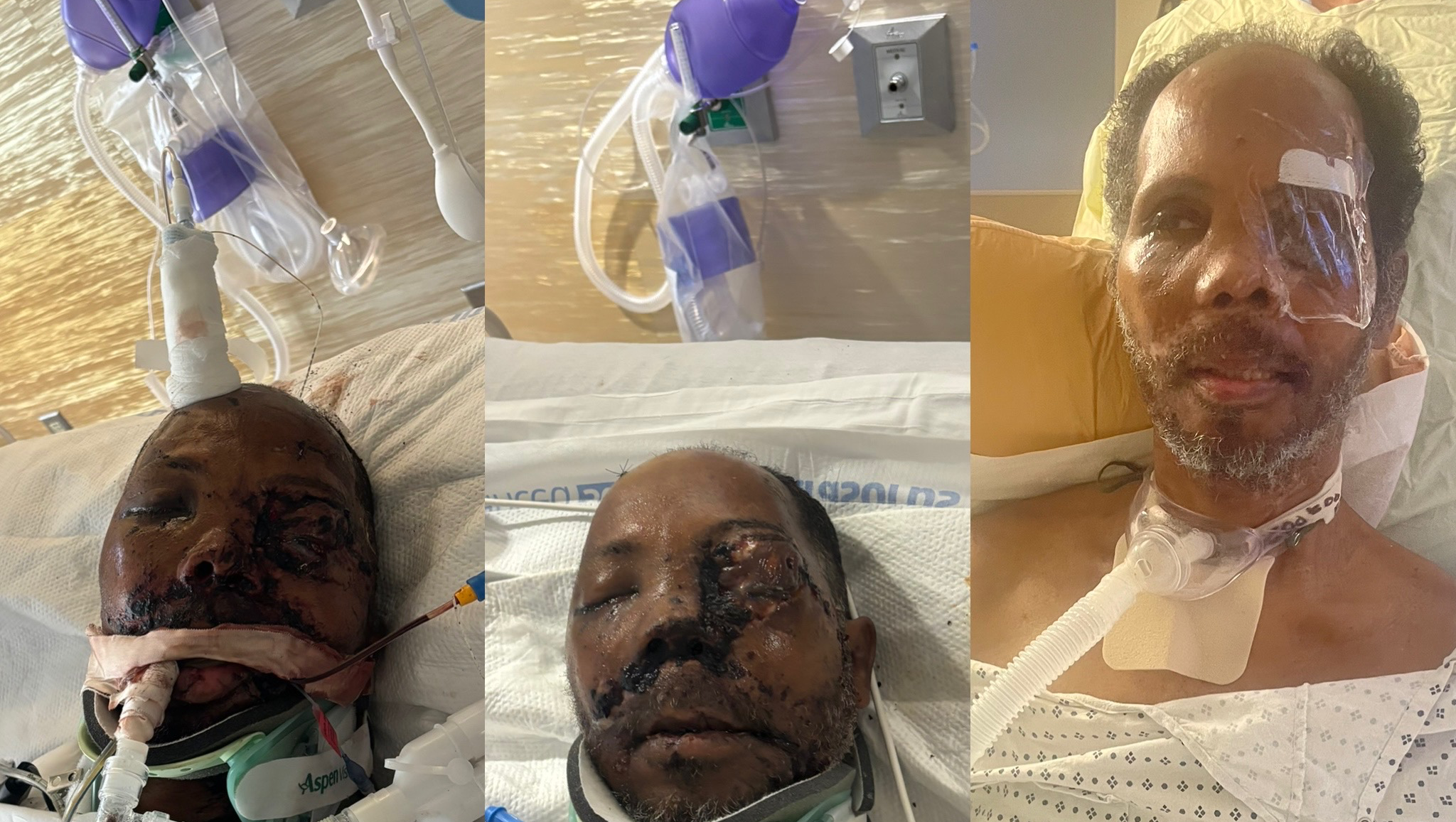 Fundraiser by Rochelle Singleton : Help Marc “Ghost” Recovery After ...