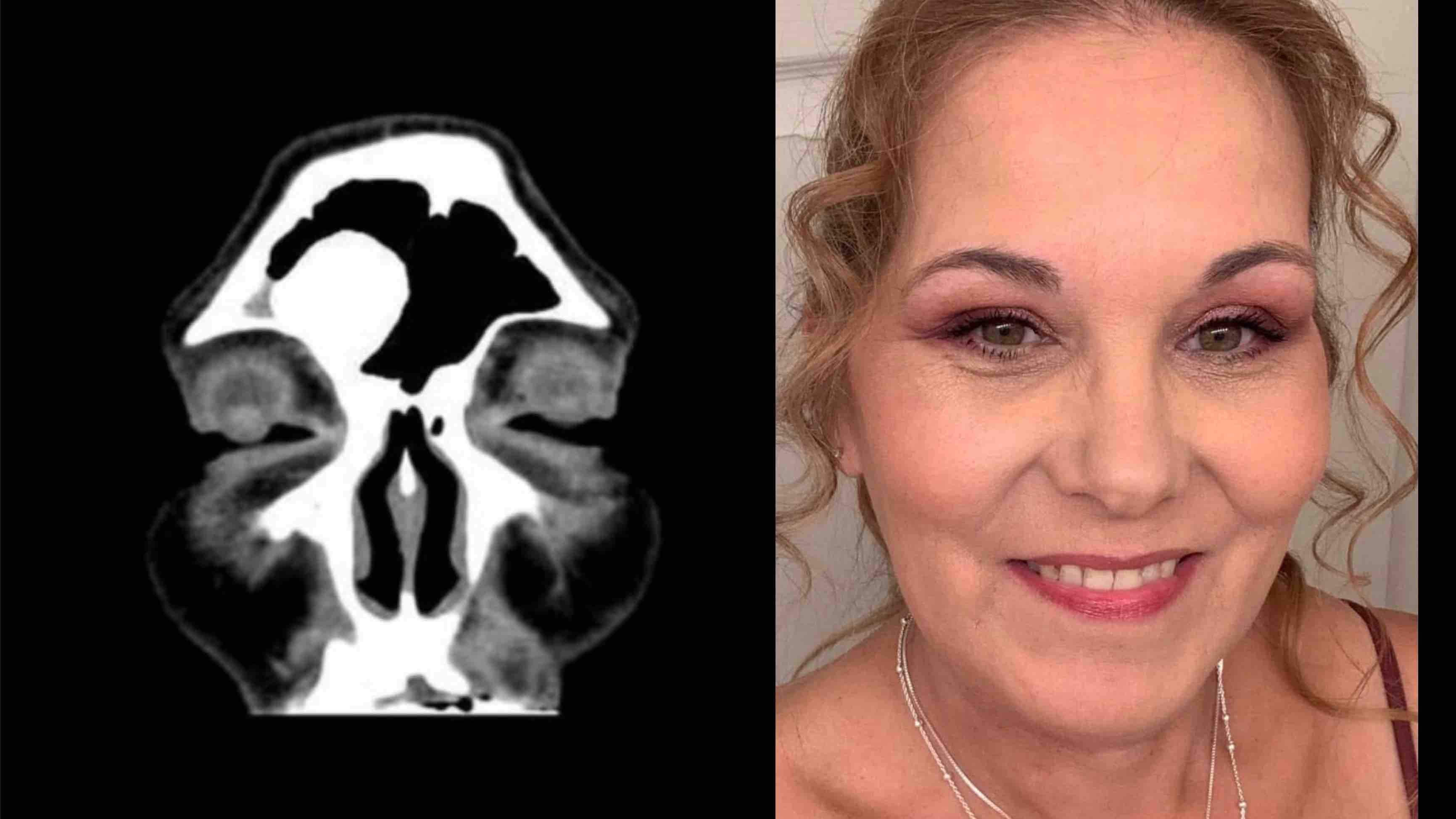 Fundraiser for Katherine Block by Kyrah Heusel : Help Katherine Block ...