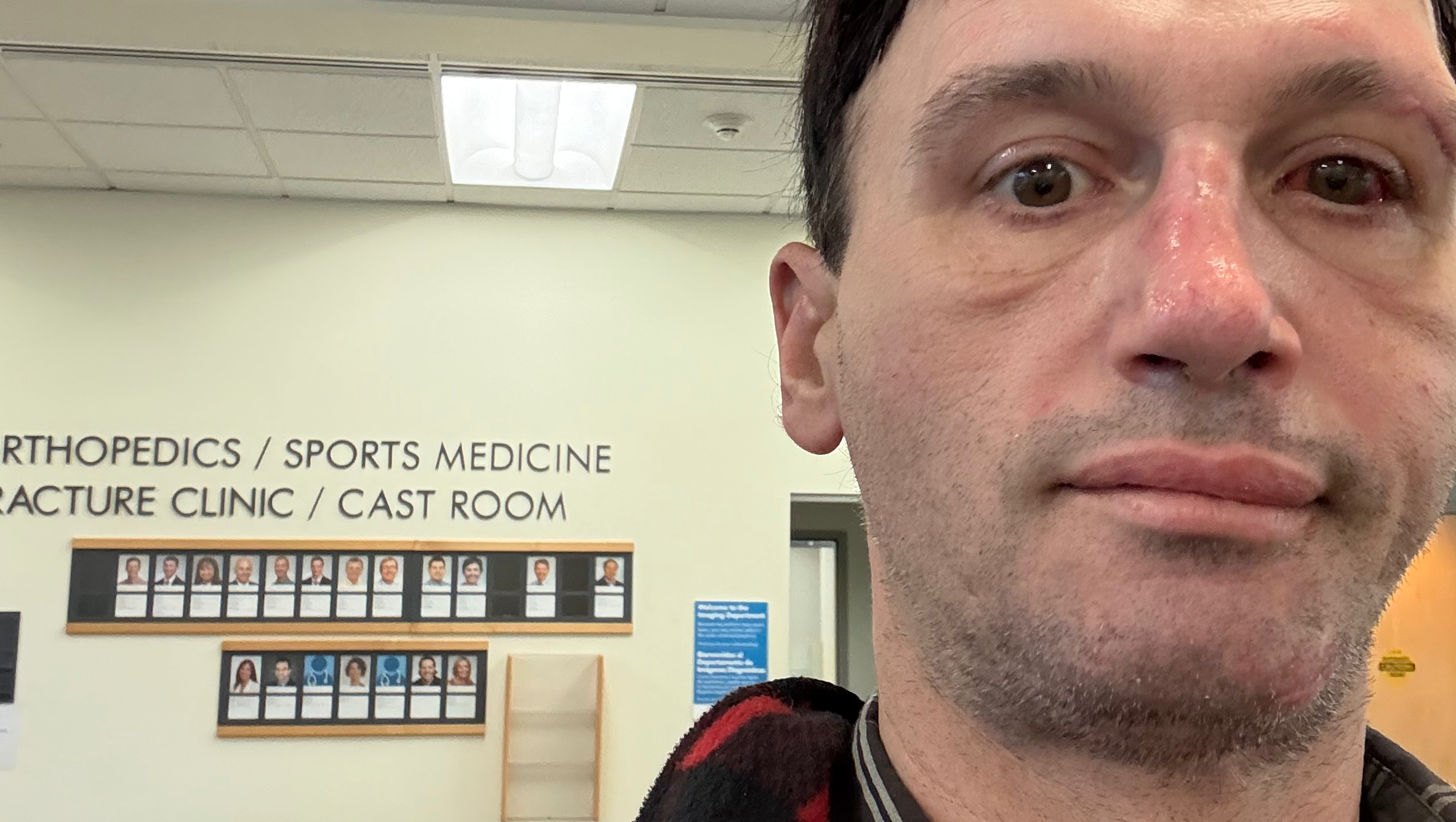 Fundraiser by Reid Sanders : Support Reid: From Crash to Recovery