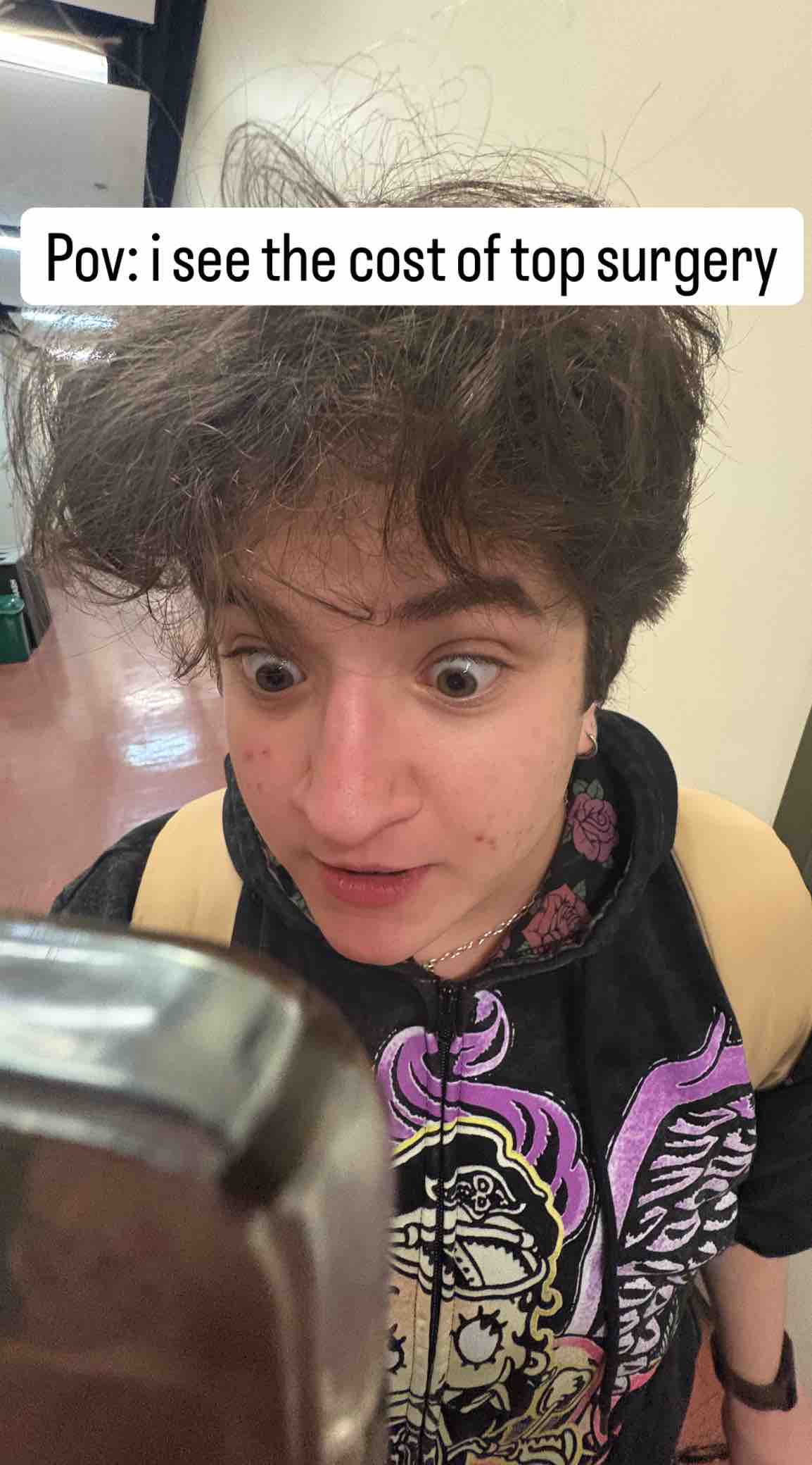 Fundraiser by Michael Scarpelli : Support Michael's Life-Affirming Surgery