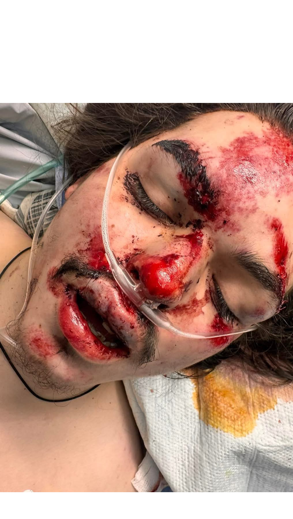 Fundraiser by Jade Molina : Rally for Dallas: Healing After the Crash