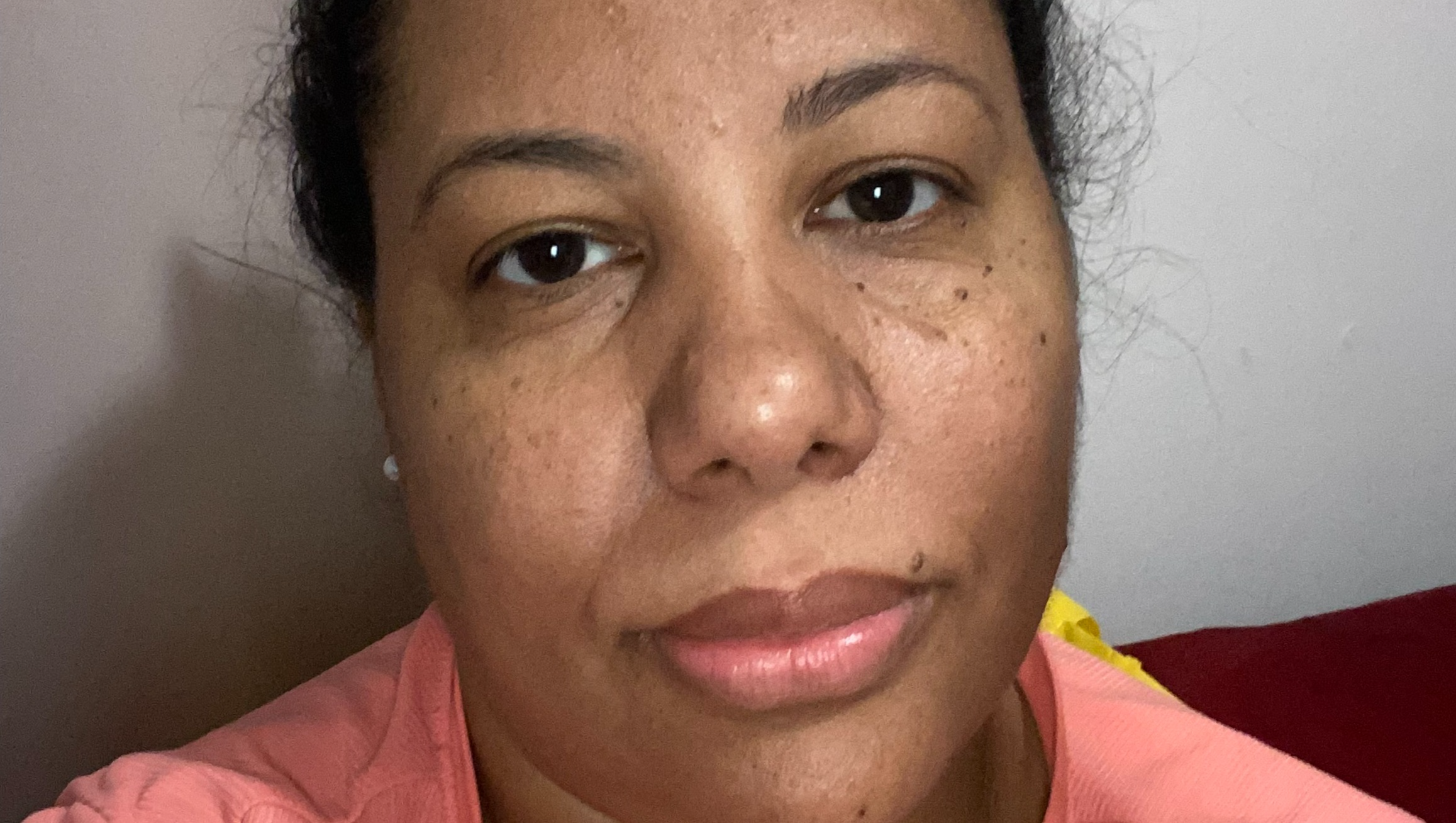 Fundraiser by Esther Fabian : Donate for Esther's Lupus Testing and Care