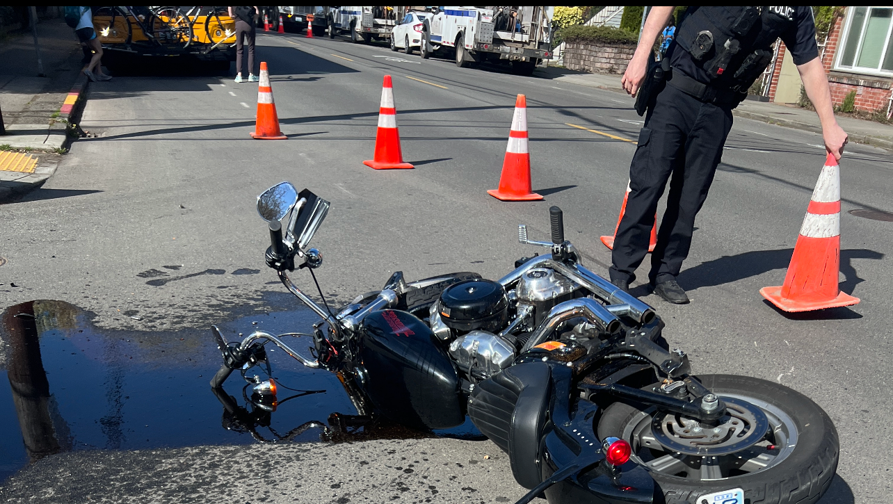 Fundraiser for Xavier Arnold by James Ryan : Stand with Xman after his ...