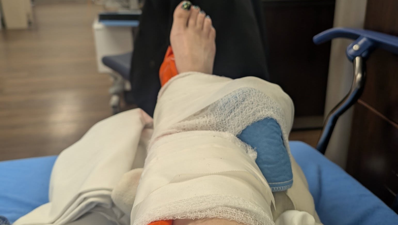 Fundraiser by Camille Richardson : Camille's Ankle and Leg Recovery ...