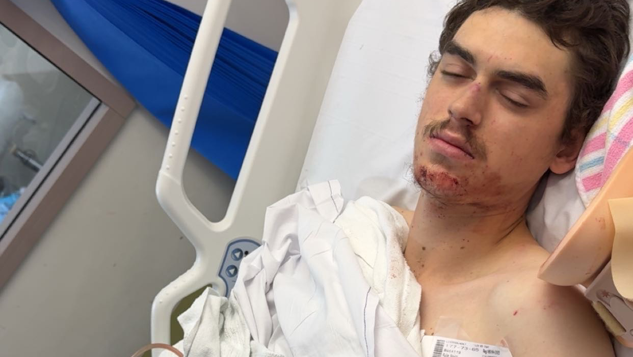 Fundraiser by Jayde Bugatto : Kyle Bugatto, Bike accident