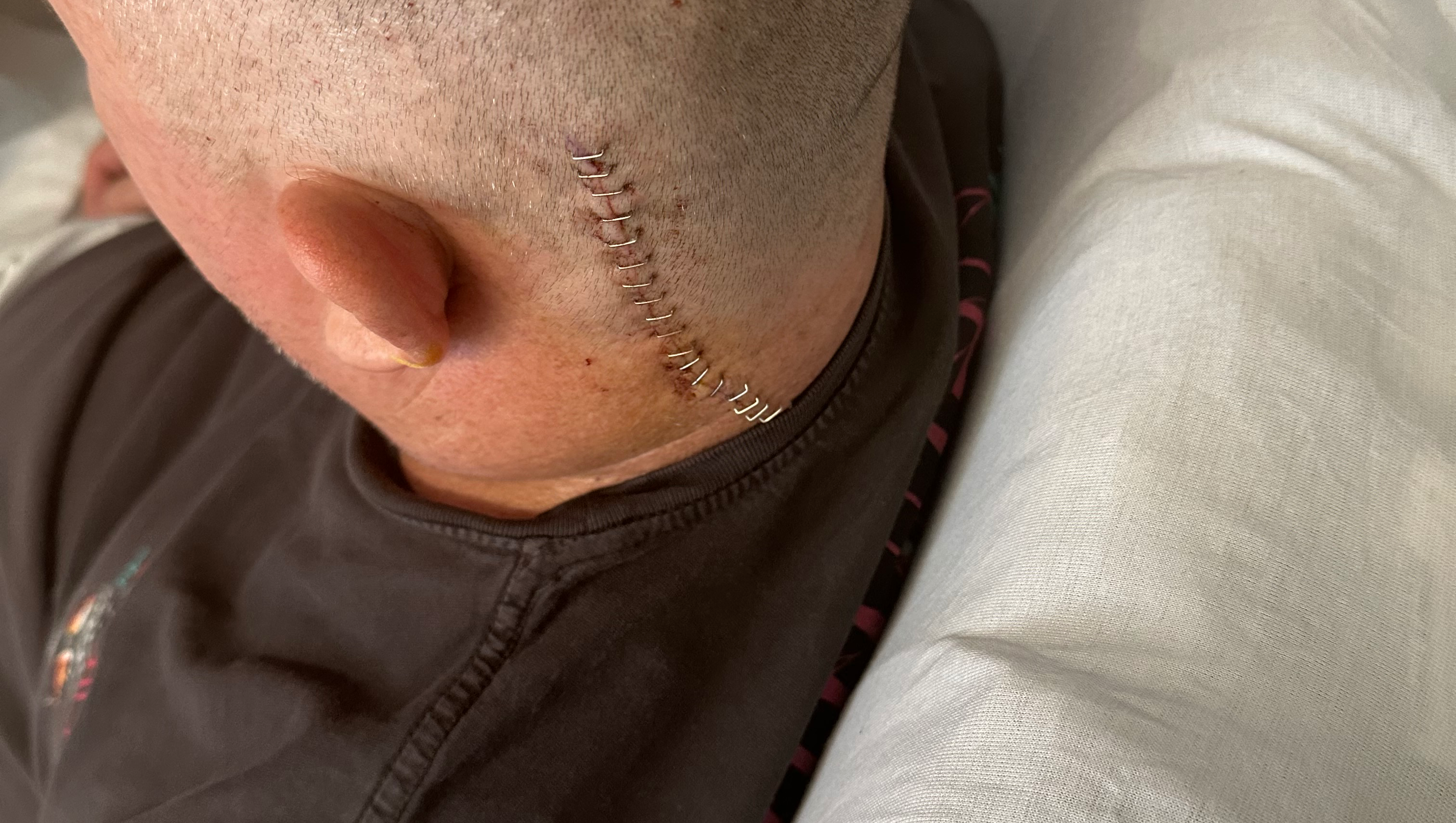 Fundraiser by Mary Green : Support Terence Green's recovery from brain ...