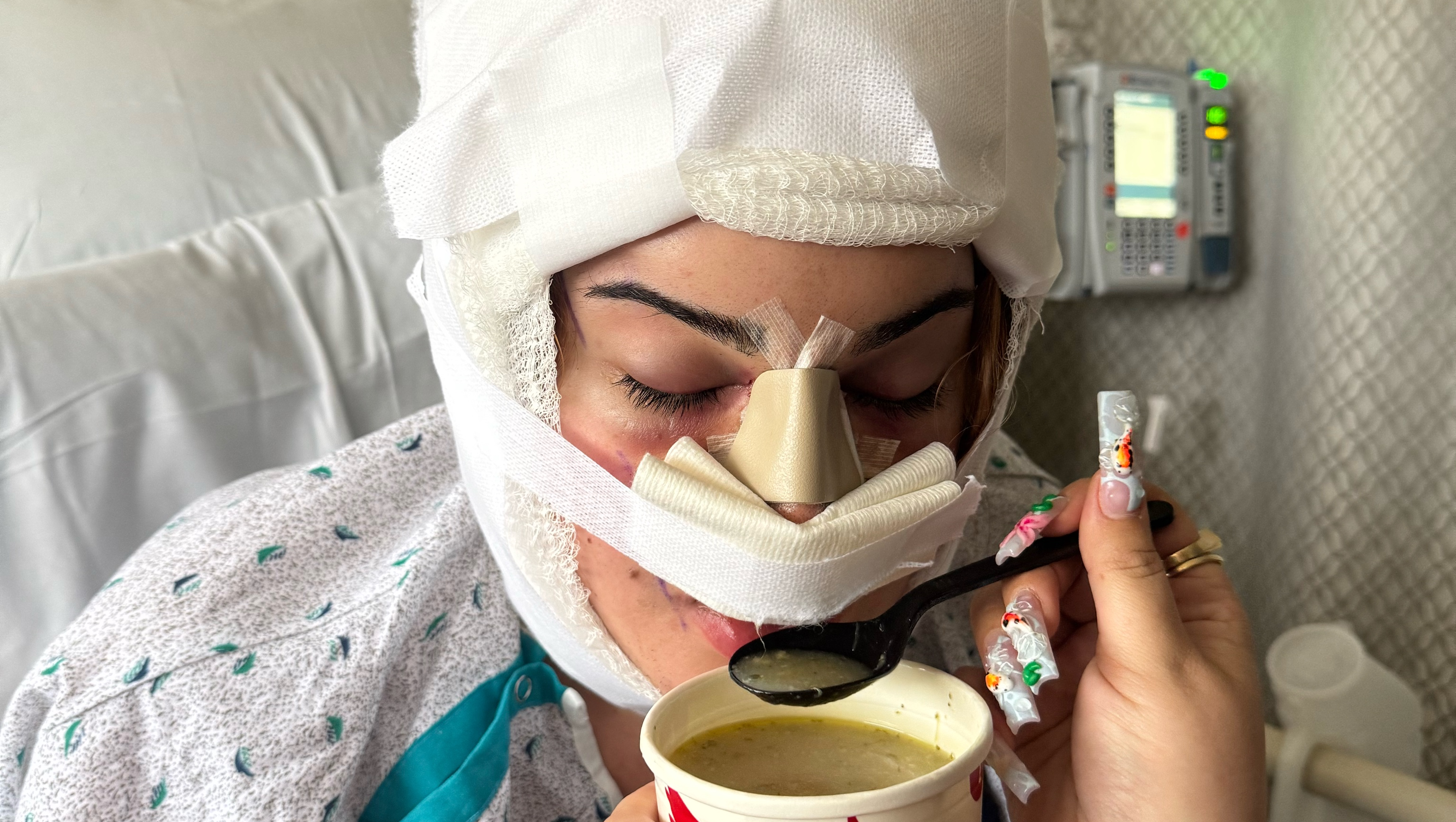 Fundraiser by Xavier Smith : Support Genesis’ FFS Healing Journey