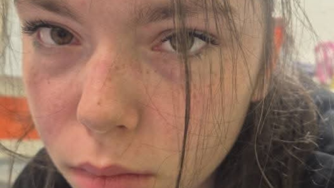 Fundraiser for Katrina Lyden by Susan Milligan : People DO care, Hope ...